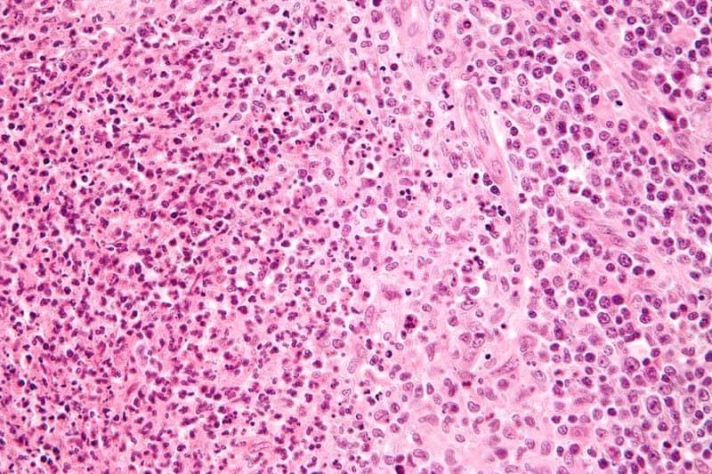 Bartonella is Everywhere, So Why Don’t We Know More About It? - North ...