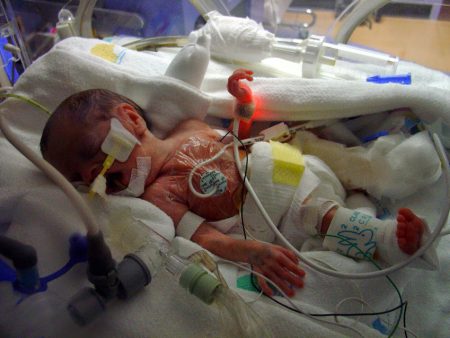 Families with Medically Fragile Children Face New Waitlist for Medicaid ...