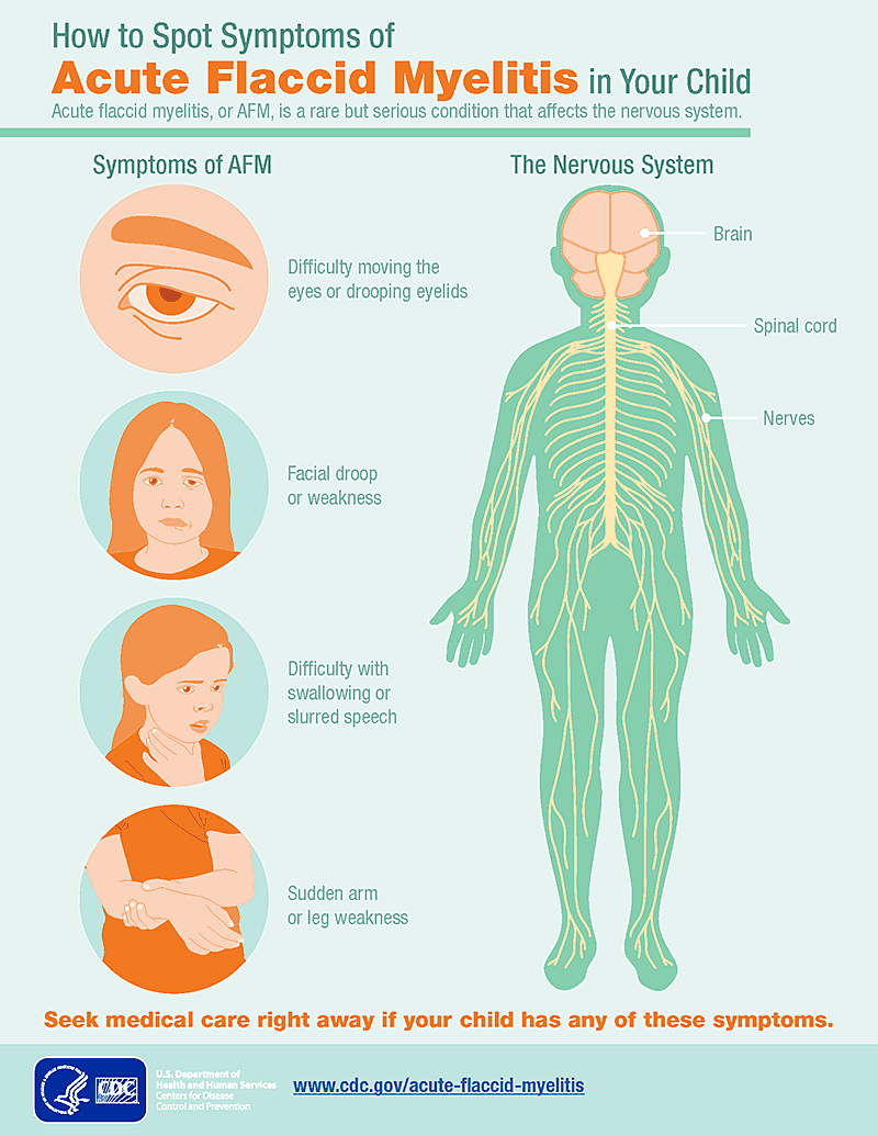 afm-symptoms-infographic - North Carolina Health News